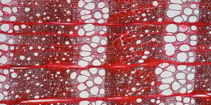 Xylem by Michael Hughes